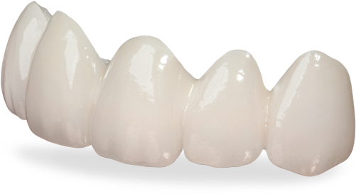 Download Lava Crowns And Bridges - Full Size PNG Image - PNGkit