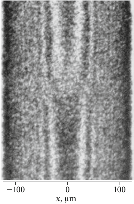 Download Fragment Of Experimental Section Topogram For The 220 - Scarf ...