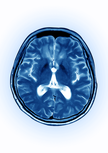 Download Brain Scan - Computed Tomography - Full Size PNG Image - PNGkit