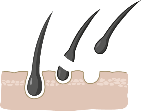 Download Regrow Restablece Y Restaura Los Folículos Capilares - Raiz De ...