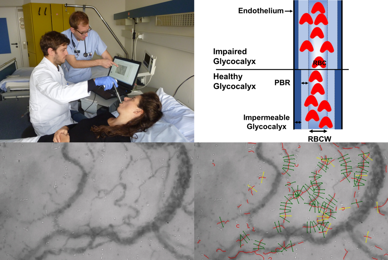 Download Glyco Check Pbr - Full Size PNG Image - PNGkit