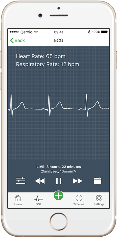 Download How To Read An Electrocardiogram - Afib Heart Rate Monitor ...