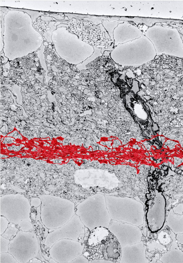 Download Starburst In Dataset-600x1110 - Monochrome - Full Size PNG ...