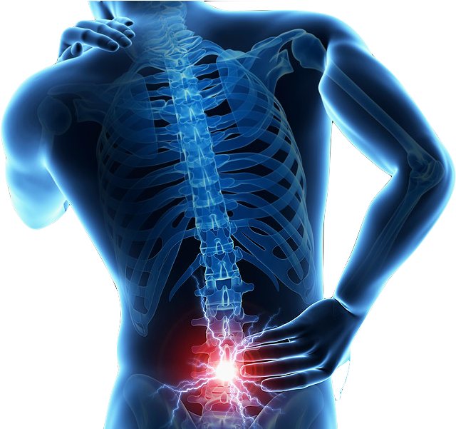 Download Patriot Back Brace By Corflex - Full Size PNG Image - PNGkit