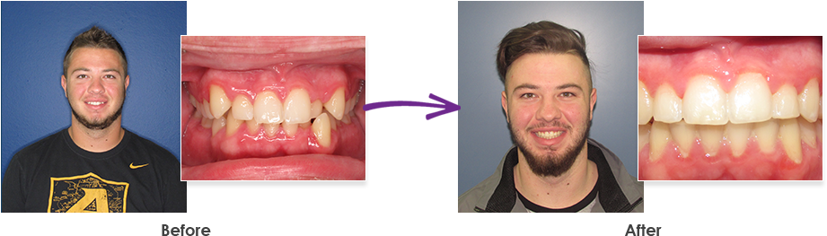 Download Lippert- - Man - Full Size PNG Image - PNGkit