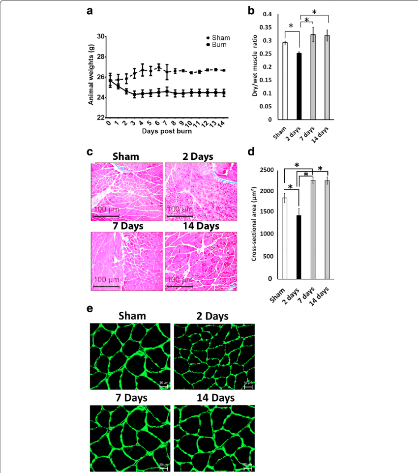 Download Thermal Injury Leads To A Transient Muscle Atrophy - Muscle ...