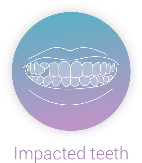 Download Ebrace Impacted Teeth - Circle - Full Size PNG Image - PNGkit