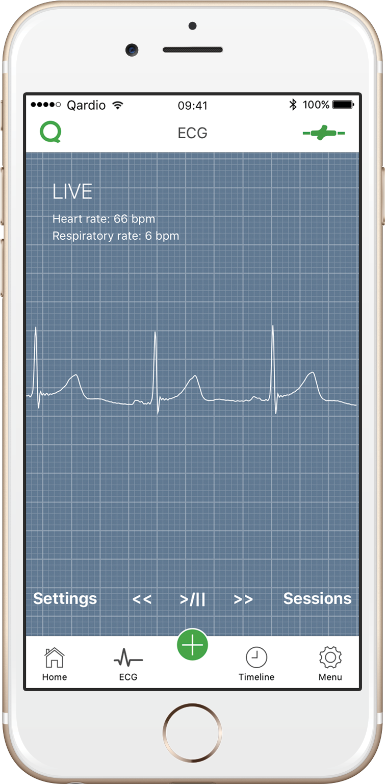 Download Ecg/ekg Trace Qardio App - Full Size PNG Image - PNGkit