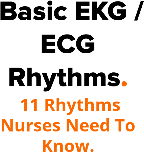 Download Basic Ekg / Ecg Rhythms - Nursing - Full Size PNG Image - PNGkit