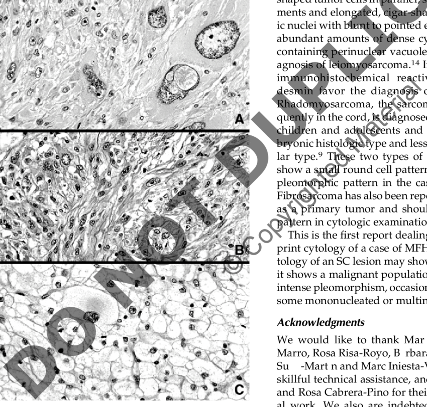 Download Neoplastic Proliferation Of Atypical Cells With High ...