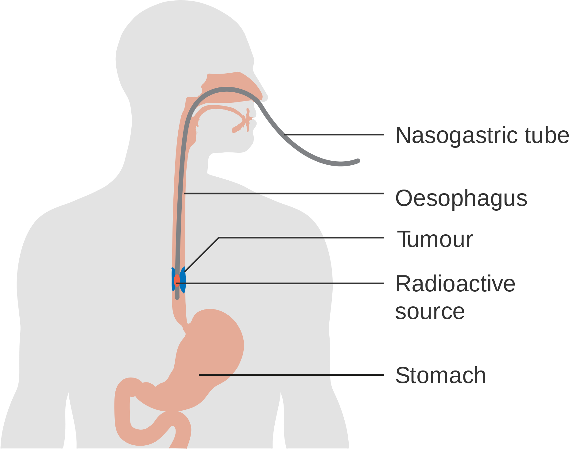 Download Open - Diagram Of The Oesophagus - Full Size PNG Image - PNGkit
