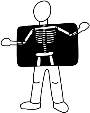 Download X-ray Png Download Image - X-ray - Full Size PNG Image - PNGkit
