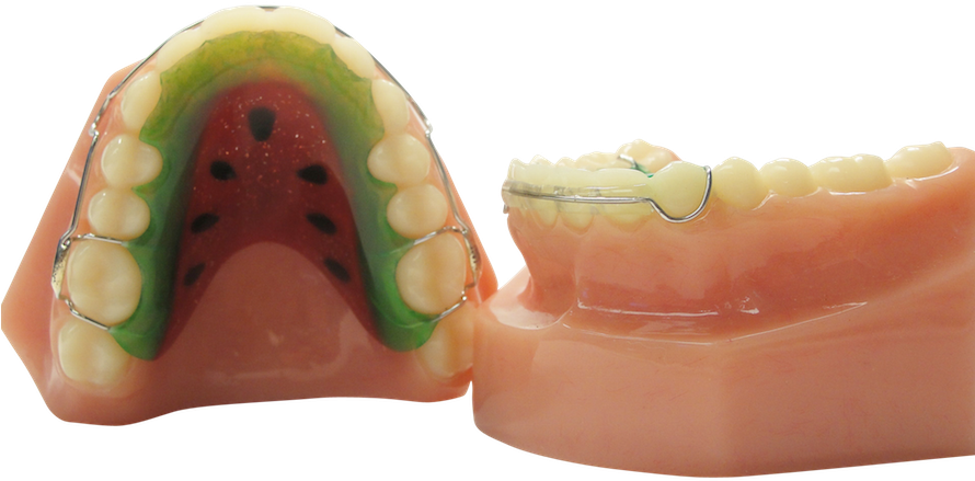 Download Hawley Retainer With Labial Bow Soldered To Adams Clasps ...