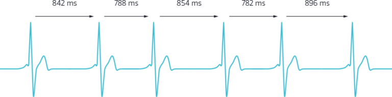 Download Between Every Heartbeat Is An Interval Of Variable - Heart ...