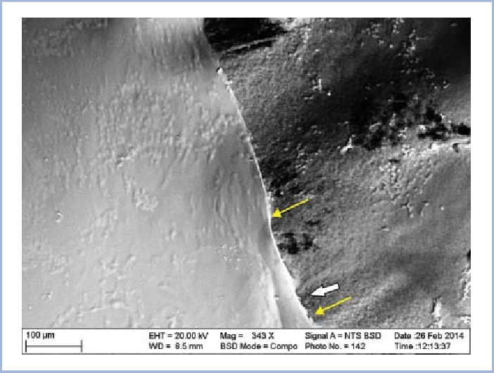 Download Sem-image Of An Anterior Lens Capsule Following Manual ...