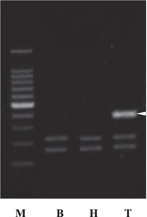 Download Restriction Pattern Of Haeiii Digested Ribosomal Rna - Full ...