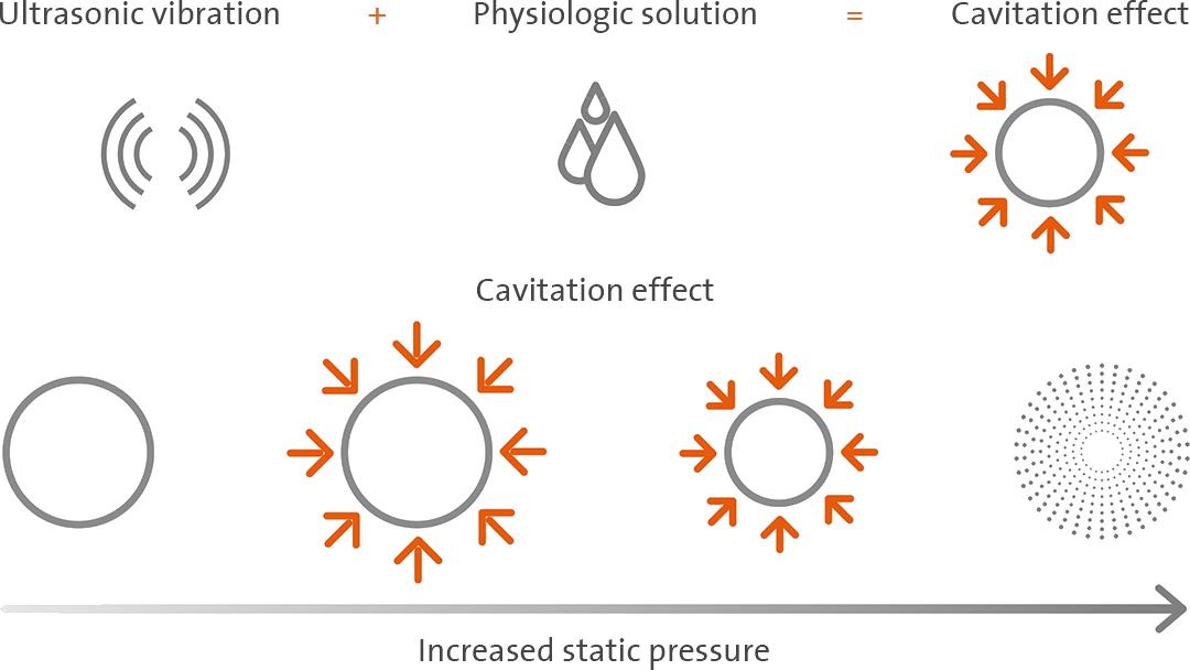 Download Implosion Of The Bubbles Generating An Intense Shockwave ...