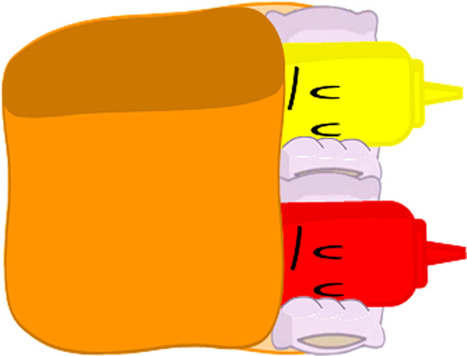 Download Ketchup Mustard S - Bfdi Ketchup - Full Size PNG Image - PNGkit