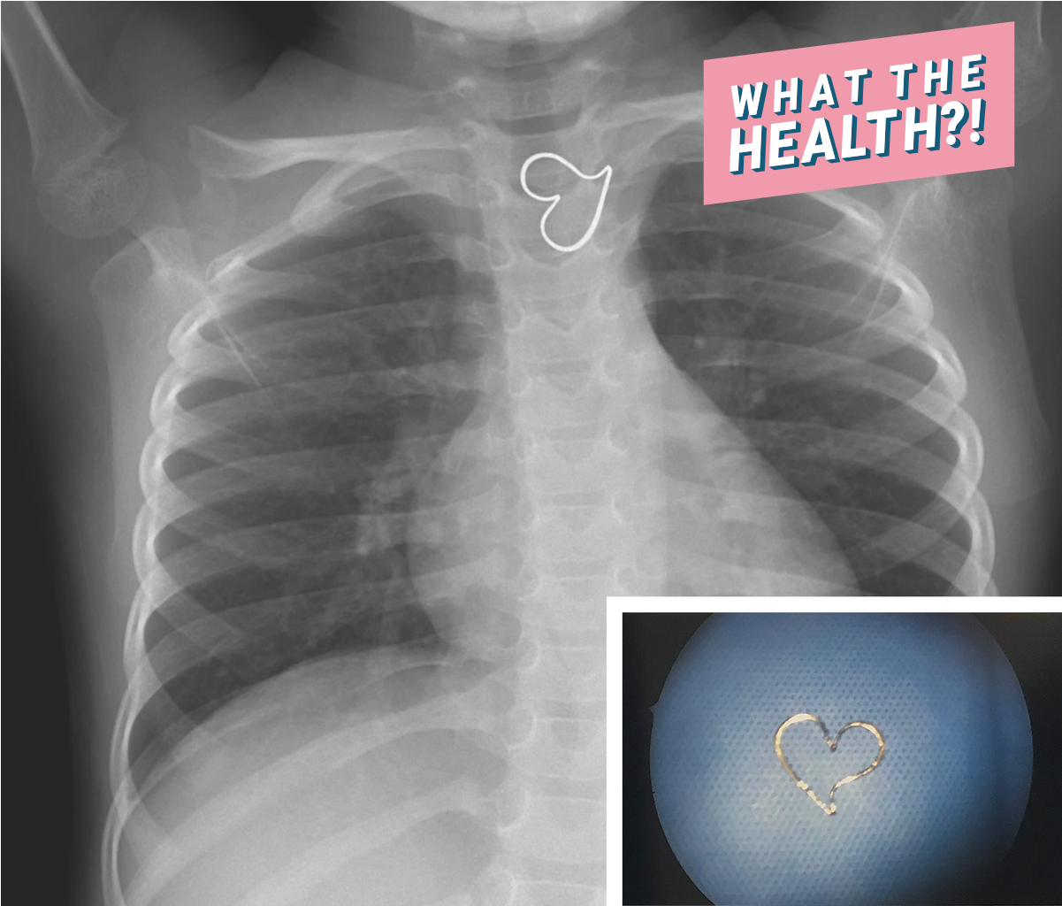 Download X-ray Heart Medical Doctor Hospital Found Woman Health - Heart ...