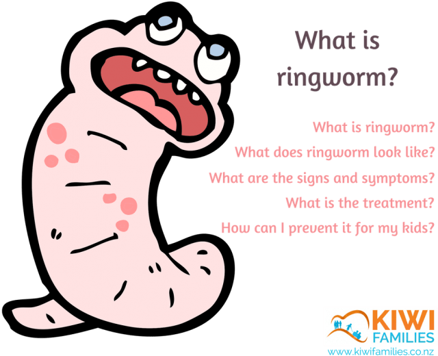 Download Ringworm - Ringworm One Year Old - Full Size PNG Image - PNGkit