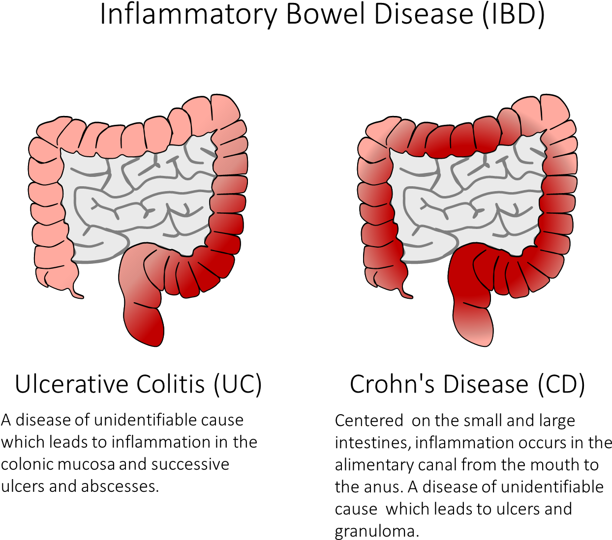 Download Transparent Figure 1) Ibd Is A Group Of Diseases Which Cause ...