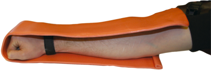 Download Anaconda Splint 1362 - Splint - Full Size PNG Image - PNGkit