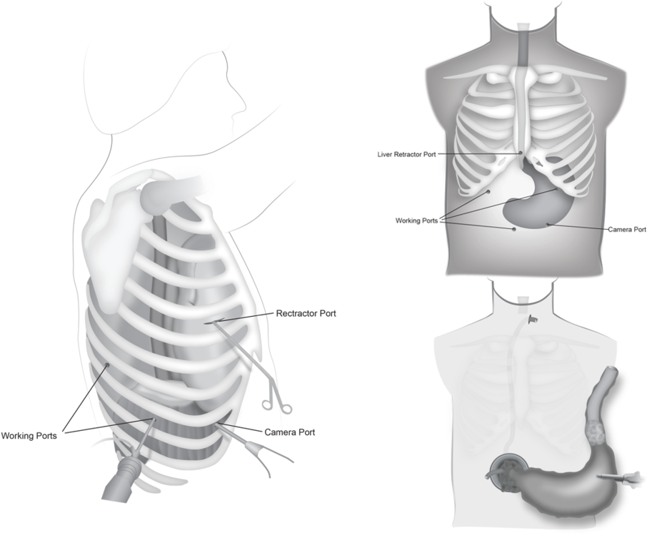 Download Stomach - Rib - Full Size PNG Image - PNGkit