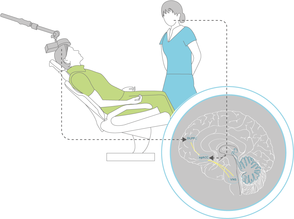 Download How Does Rtms And Psychotherapy Work In Combination - Graphic ...